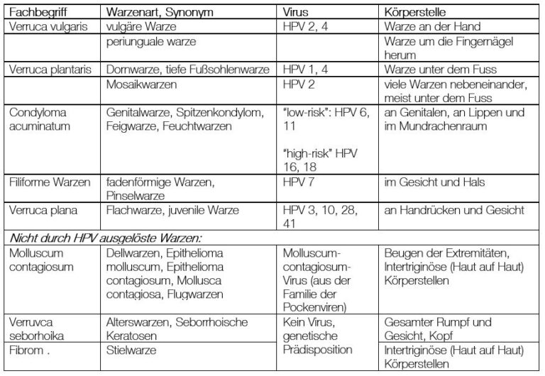 Warzen im Allgemeinen - Wo, Wie & Welche Warzen gibt es?