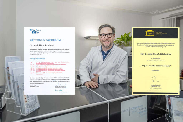 Fusswarzen & Handwarzen sowie 6 Mehtoden zur Warzenbehandlung